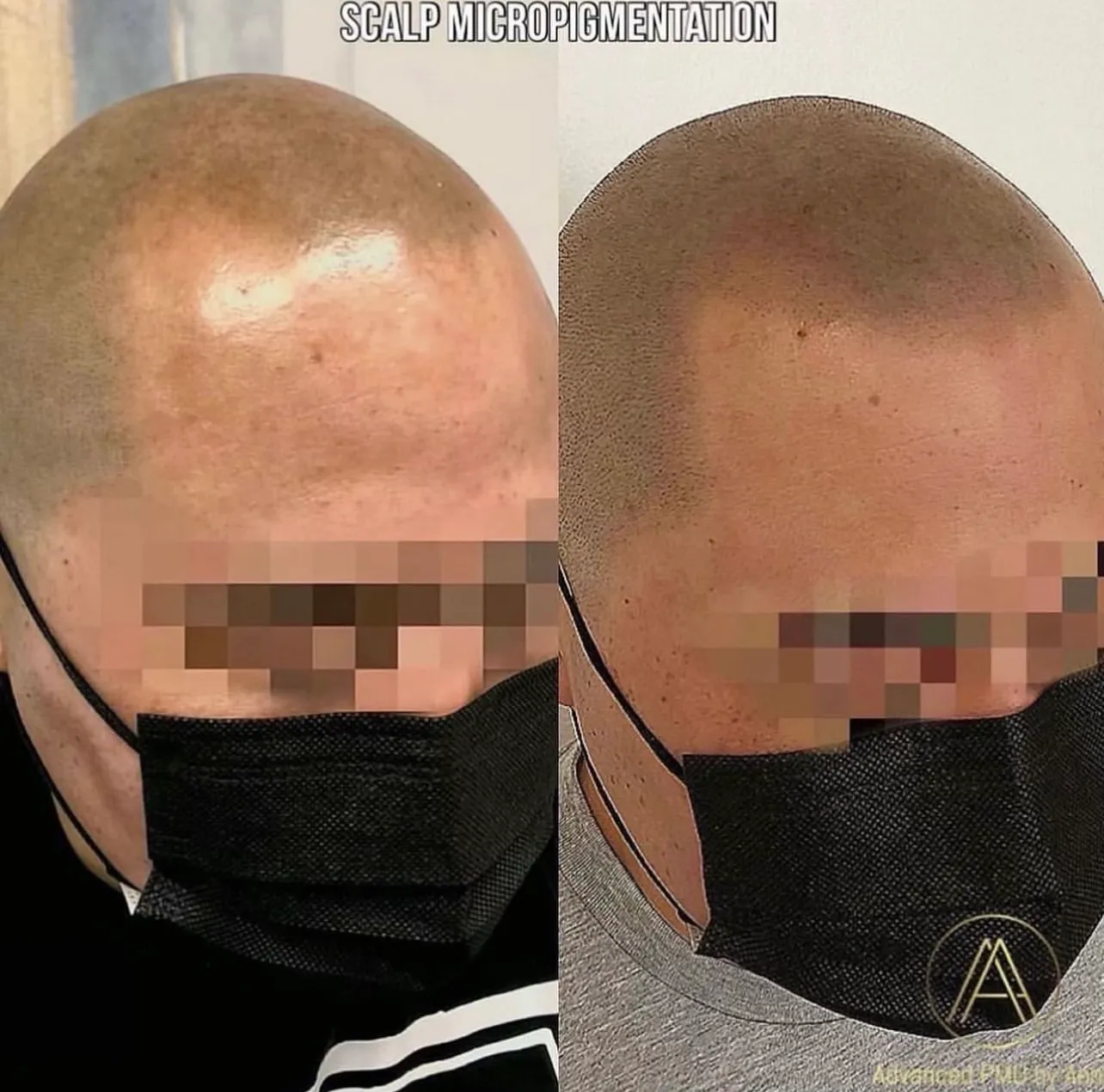 Advanced PMU - Permanent Makeup Training, Services, and Suites